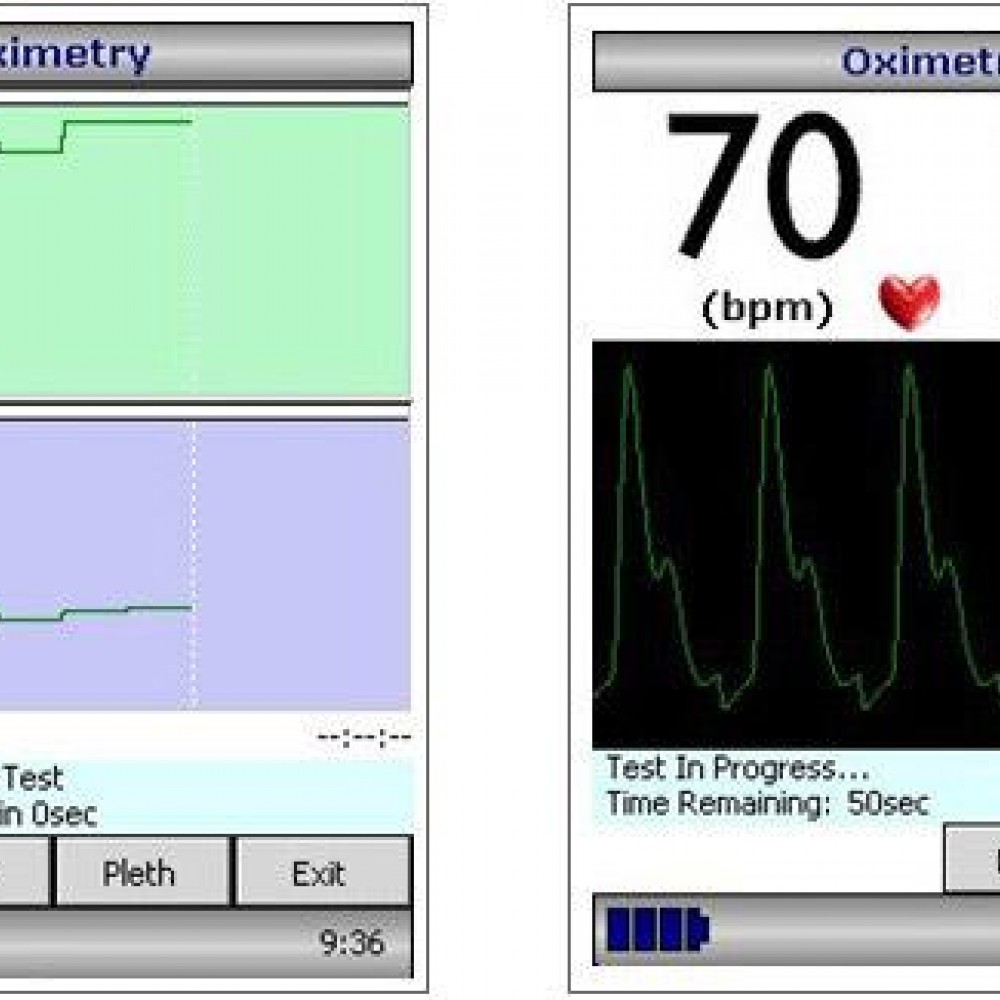 Pulse Oximetry Module - Respiratory - MEDI-MOVE | Medical Supplies ...